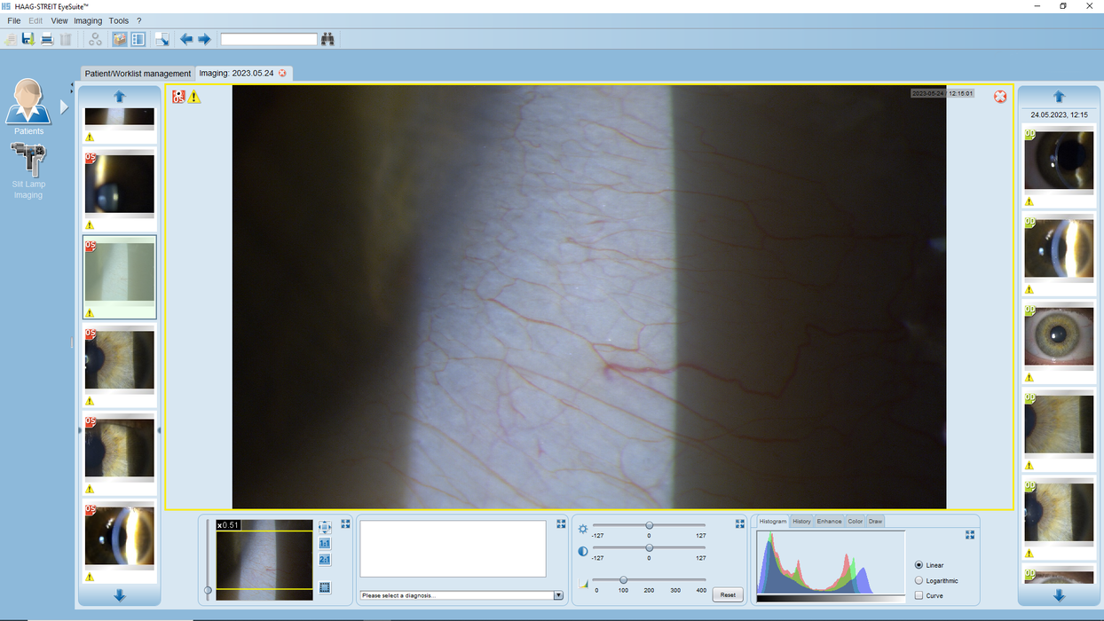 スリットランプイメージング